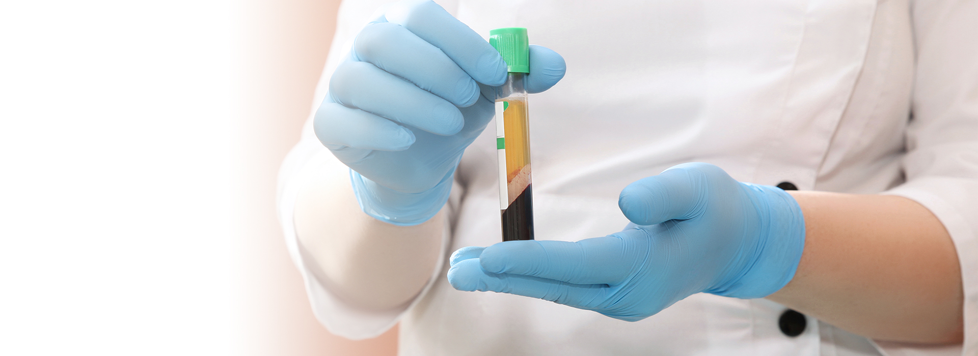 Natural Growth Factor Injections in Raleigh, NC | Beauty Co